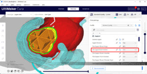 Cura Tree Support: A No-Nonsense Guide With 4 Critical Settings ...